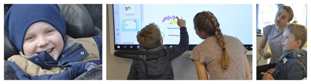 Medisinsk beskrivelse av metakromatisk leukodystrofi - Frambu