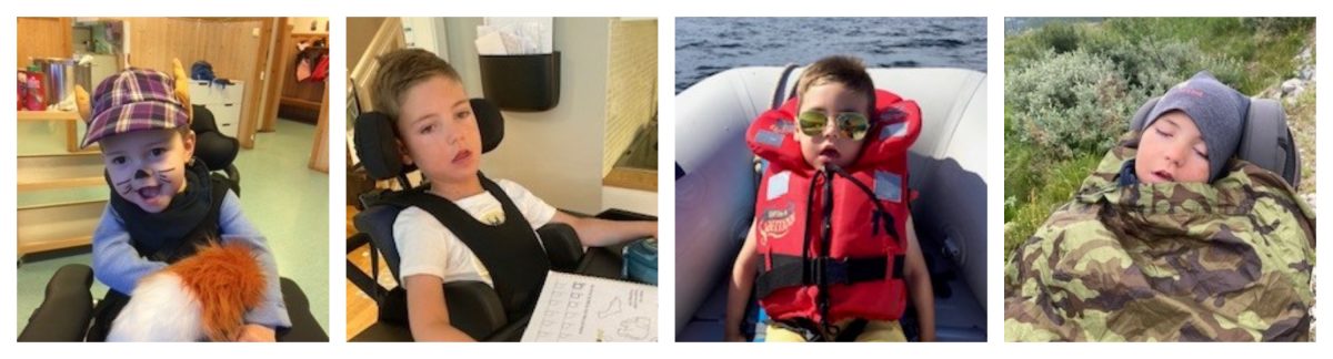 Medisinsk beskrivelse av metakromatisk leukodystrofi - Frambu