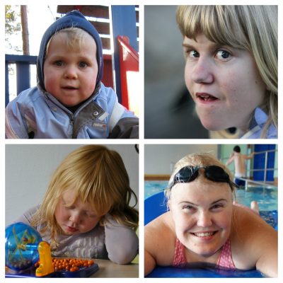 Smith-Magenis' syndrom - Frambu