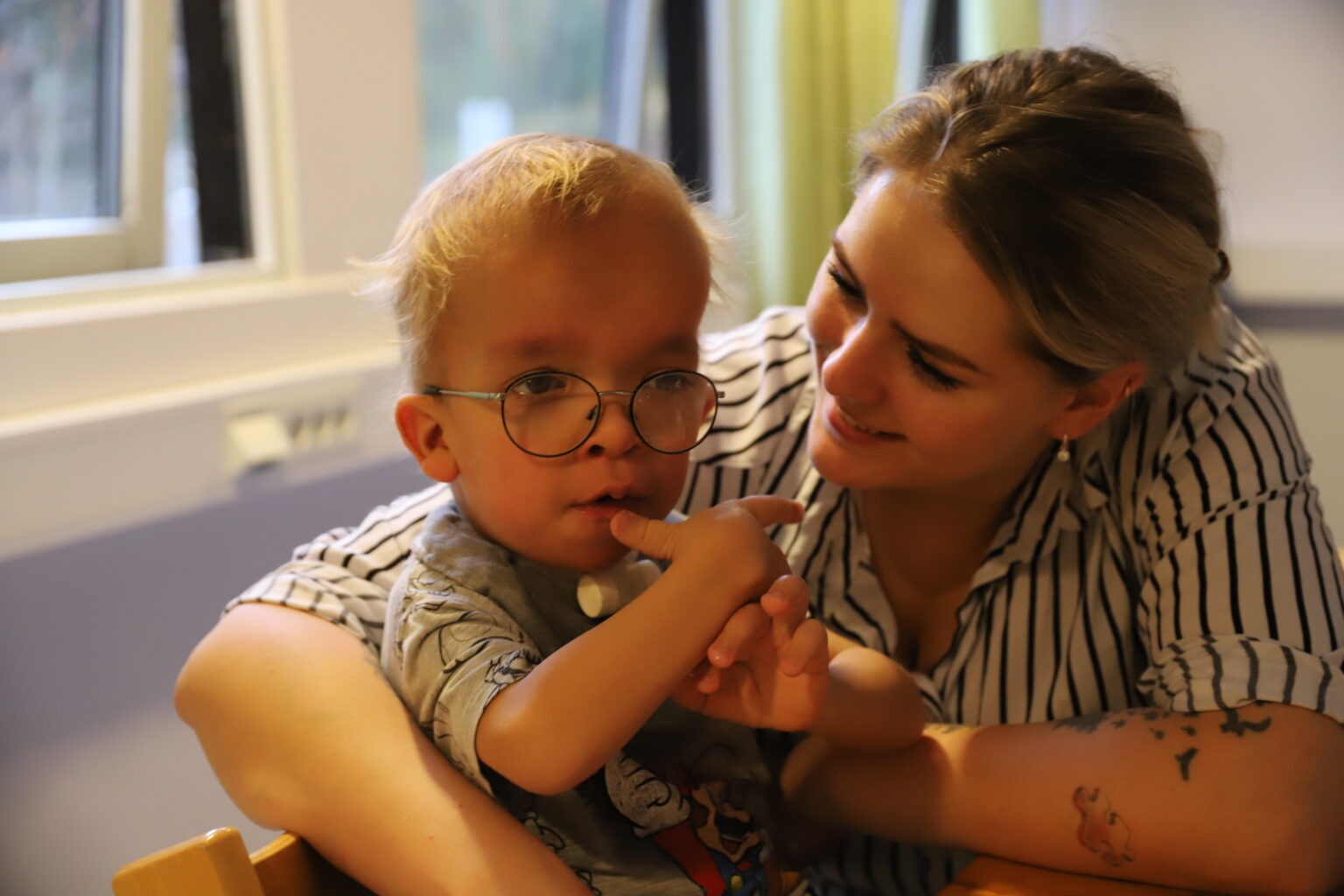 Noonans syndrom, cardiofaciocutant syndrom, Costellos syndrom (0-16 år ...